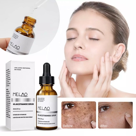 MELAO | Skincare | Niacinamide Vitamin B3 Vitamin B5 Hydrating ...